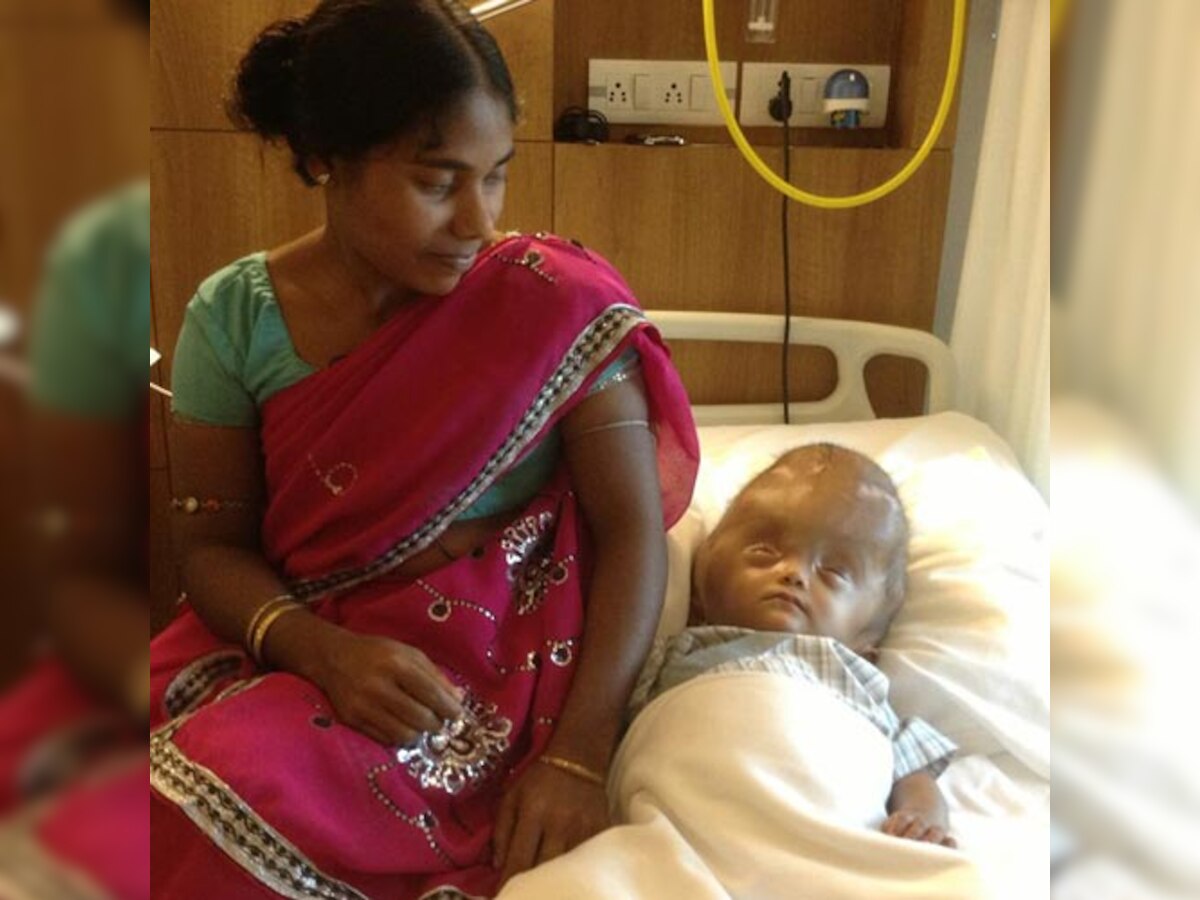 Roona Begum undergoes another surgery