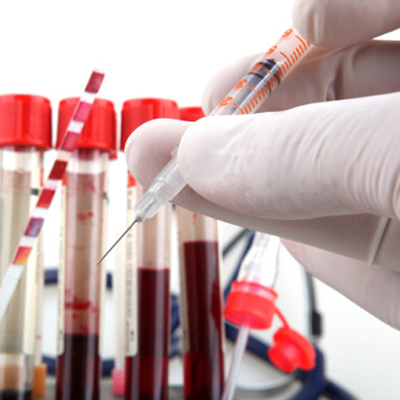Simple blood test can predict Alzheimer's Simple blood test can predict Alzheimer's