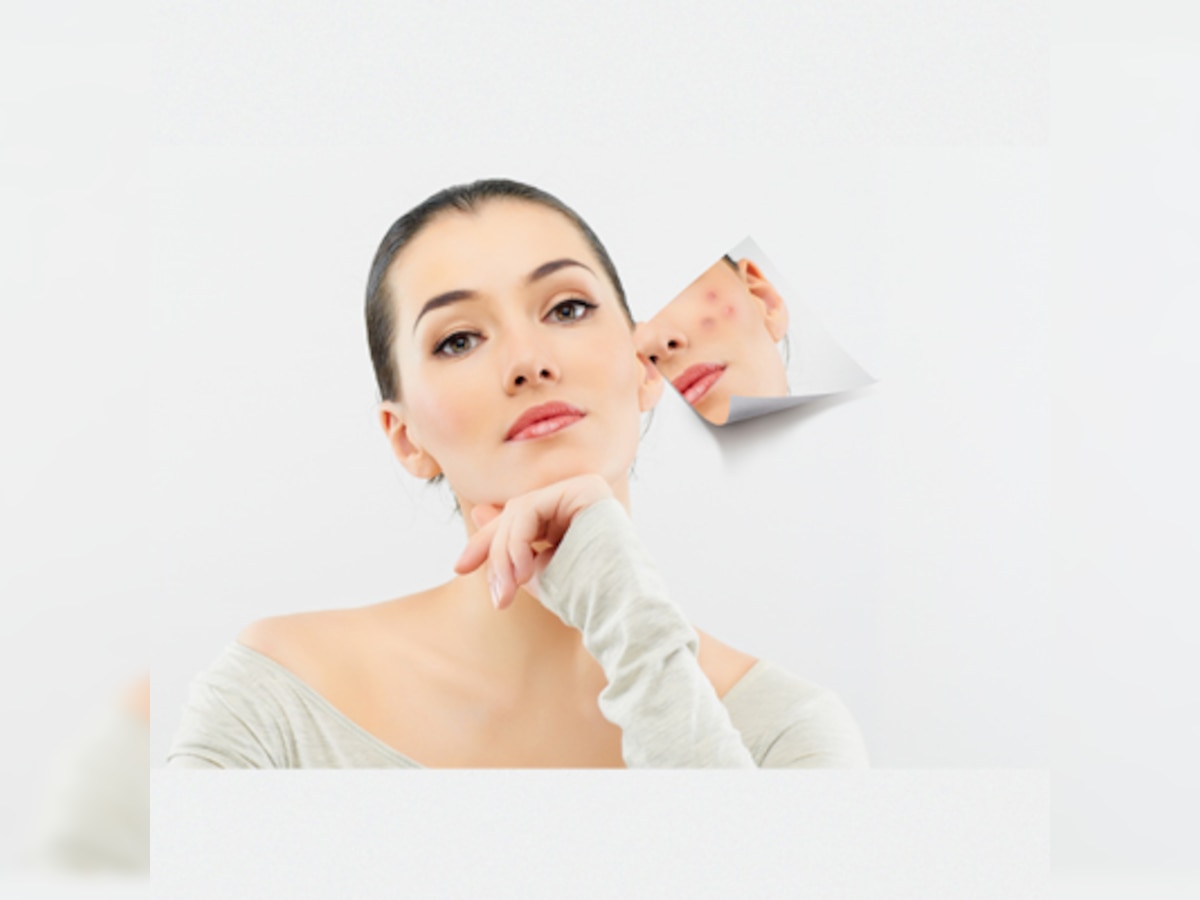 Try 'acne' app to make better food choices