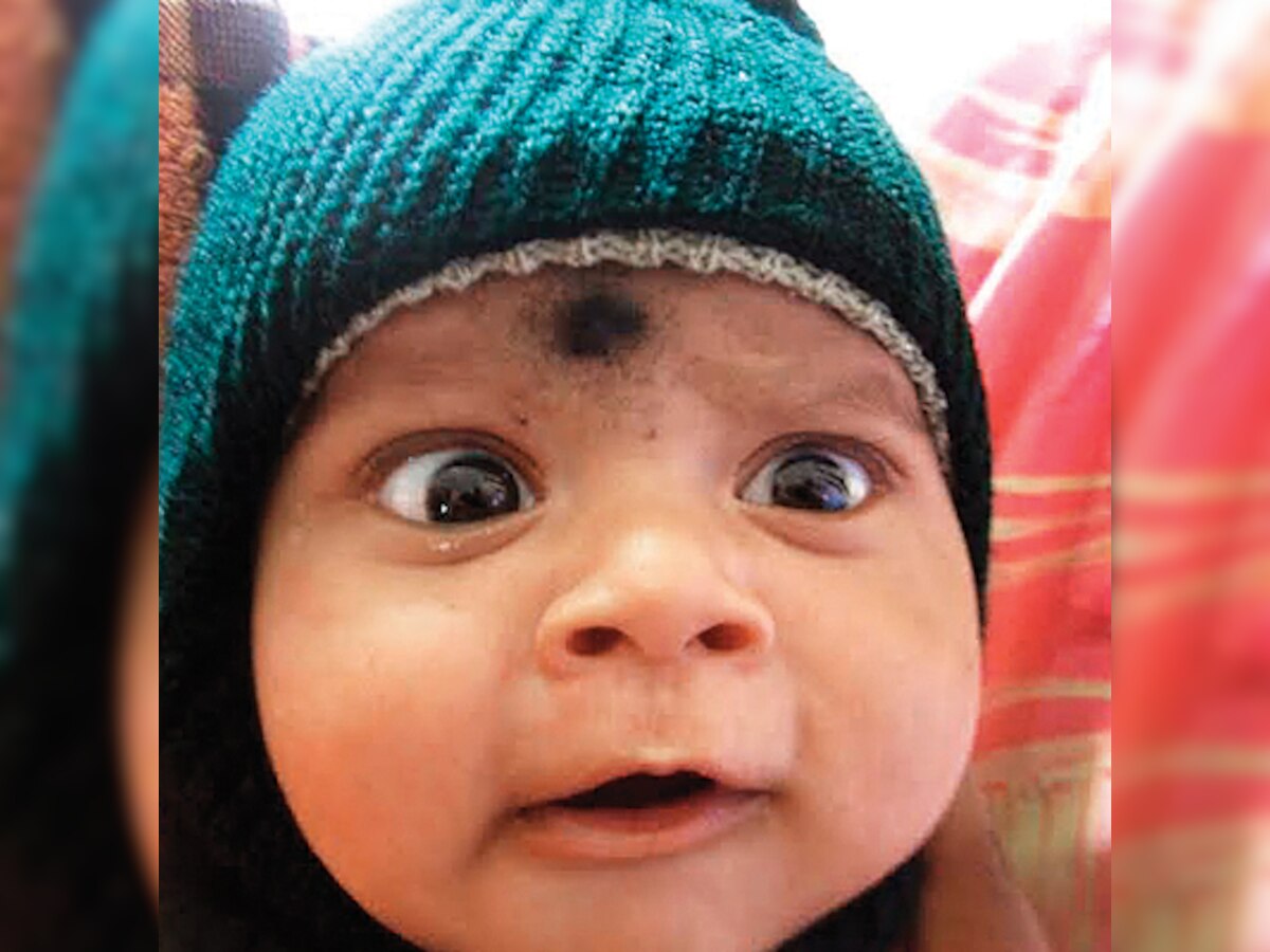 One month old\'s vision restored at Sankara Eye Hospital