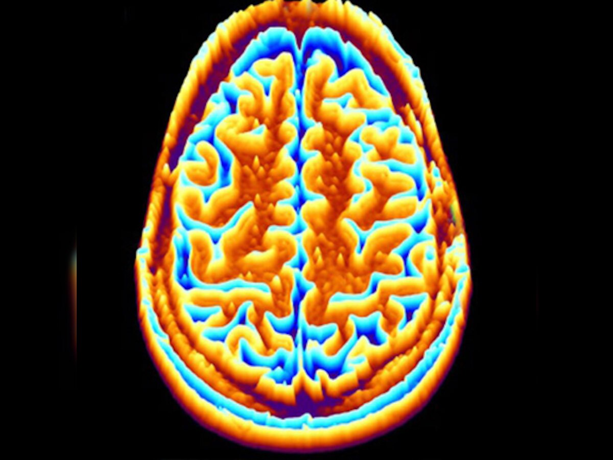 Why people forget details but maintain emotional reaction post ...