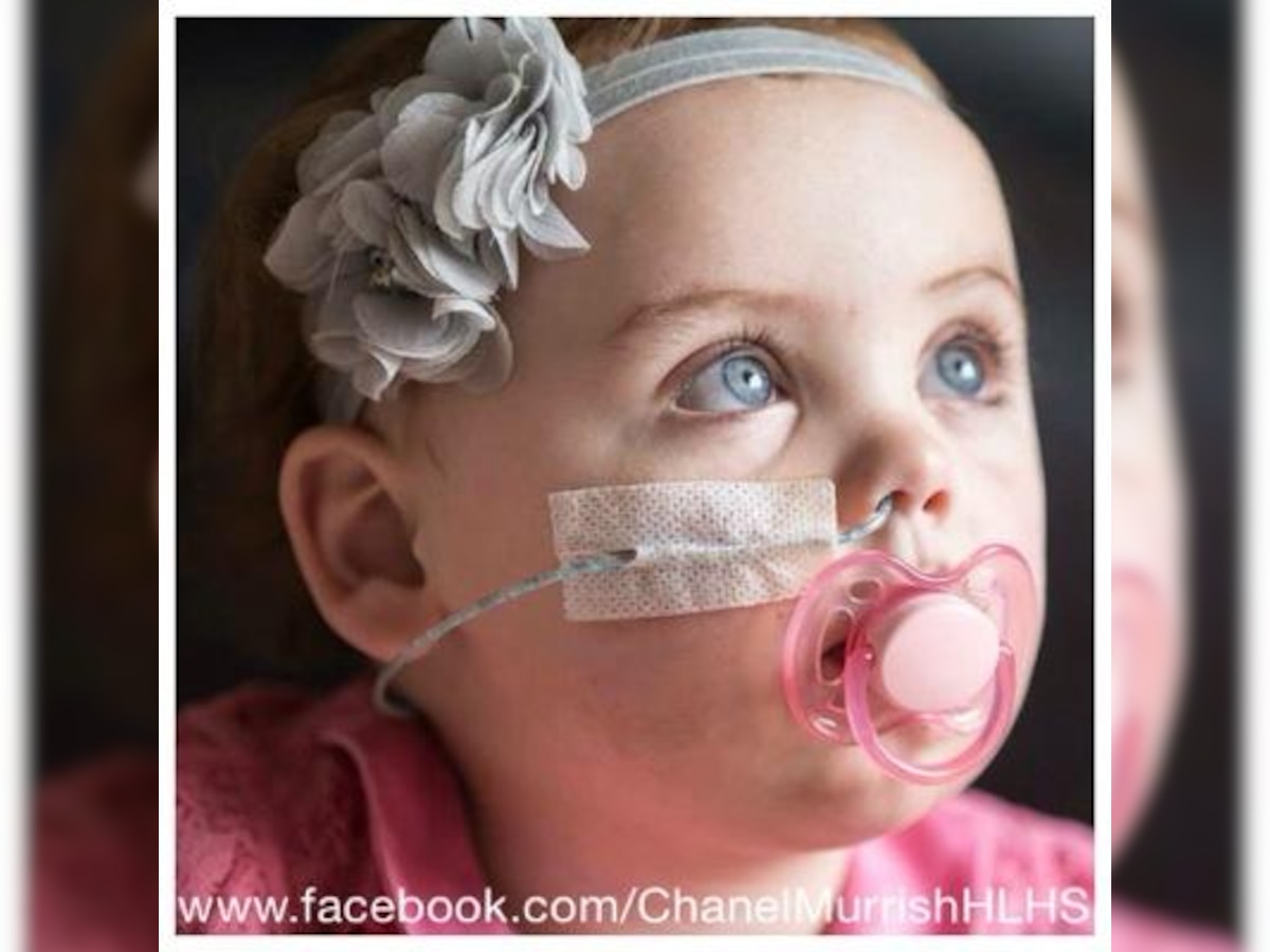 1 year-old baby becomes world's 'youngest open heart surgery patient'