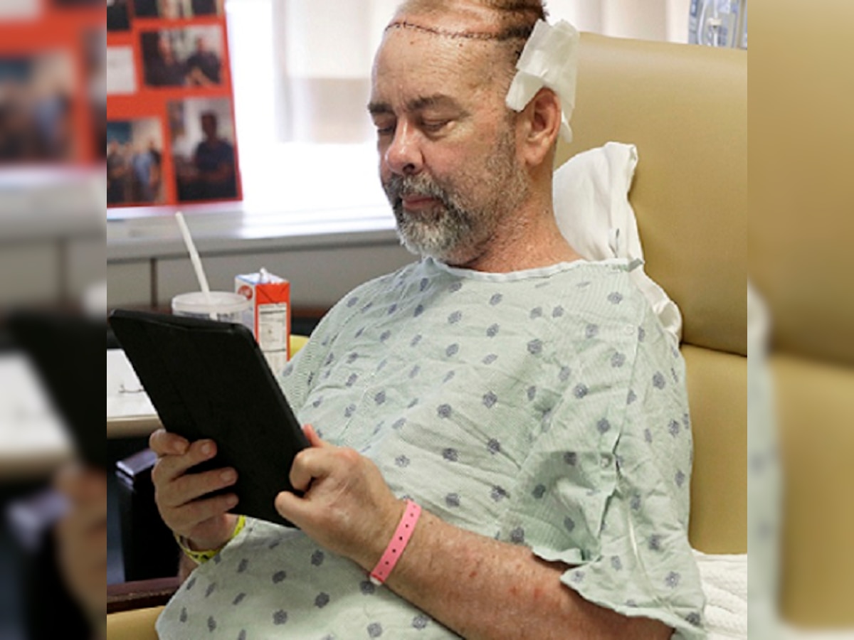 US doctors perform historic skull-scalp transplant