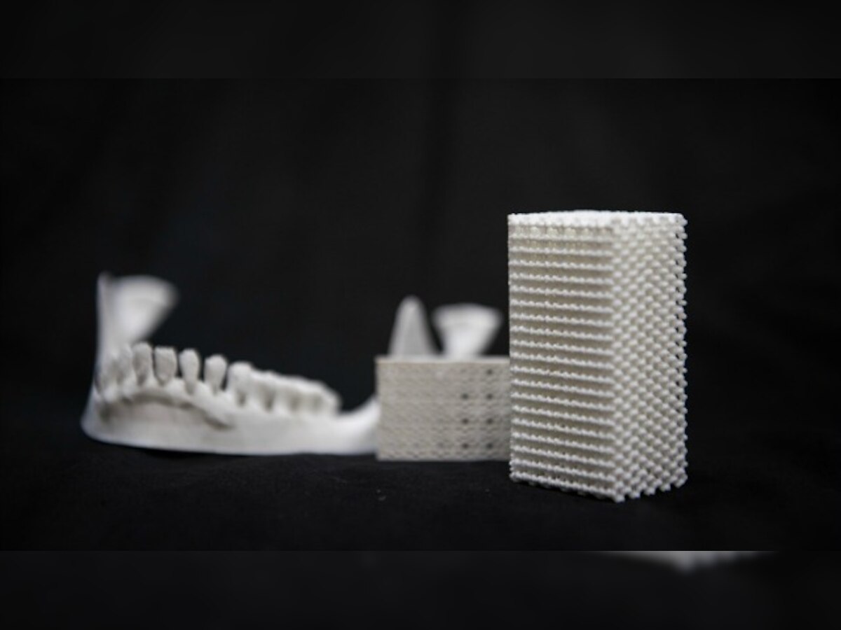 3D-printed bone implant that dissolves in body