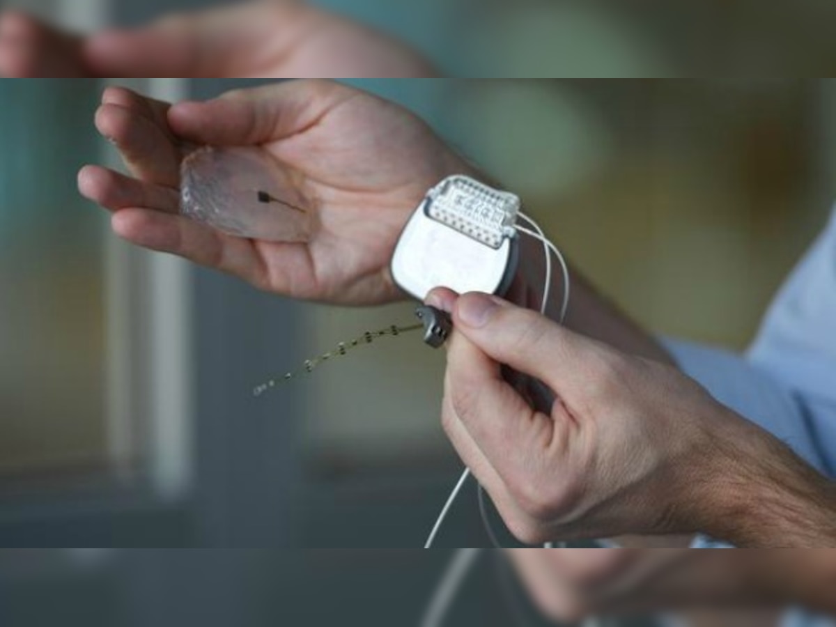 Wireless brain implants to help paralytics walk in weeks