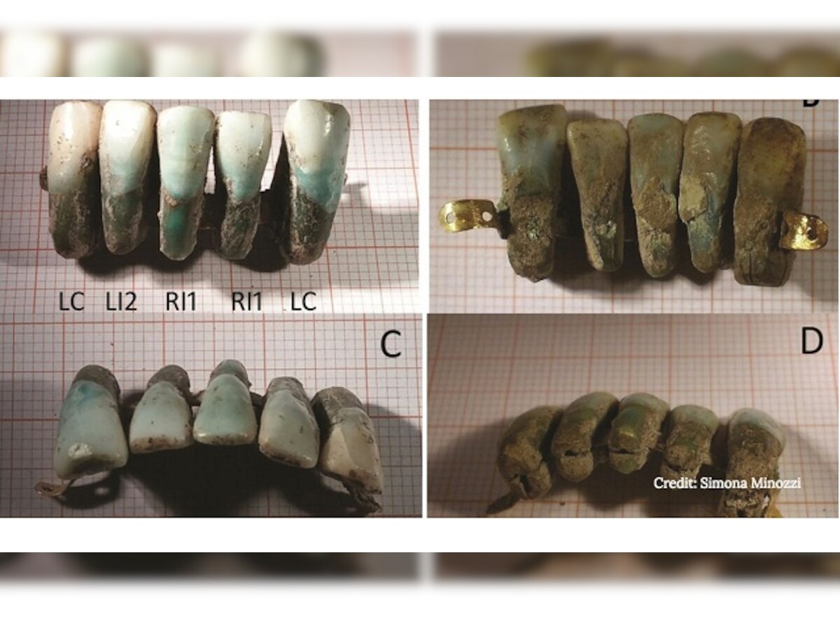 400-year-old false teeth found in Italy