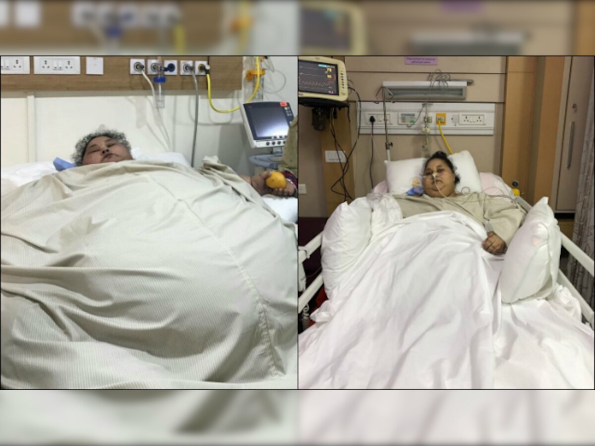 100 kgs down, Eman Ahmed undergoes first surgery