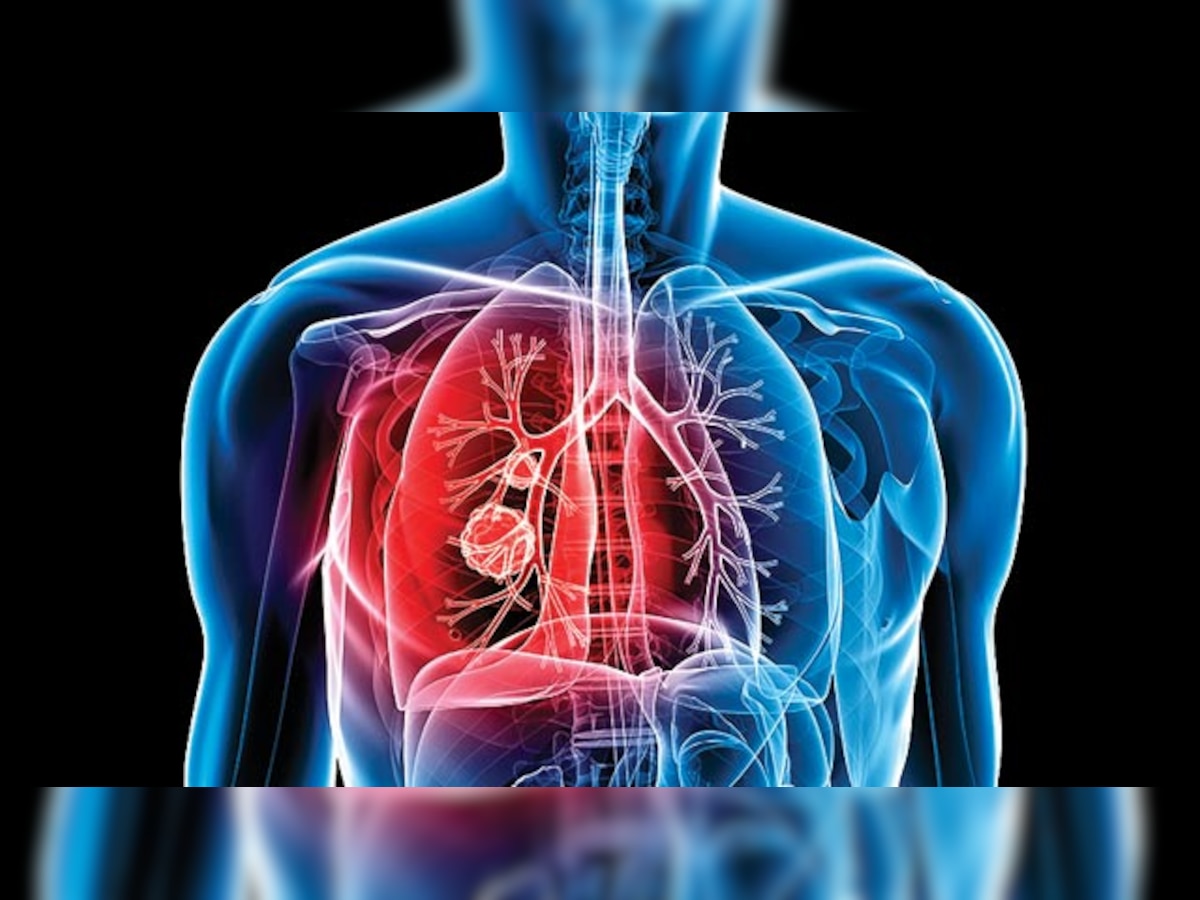 A kind word: How counselling has helped TB patients cope