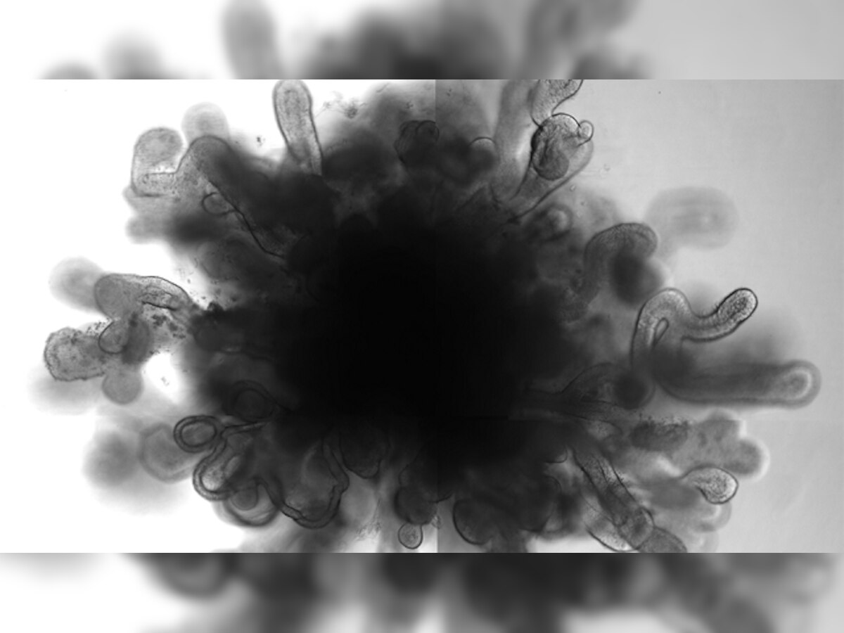 3D mini organs mimic features of full sized lungs