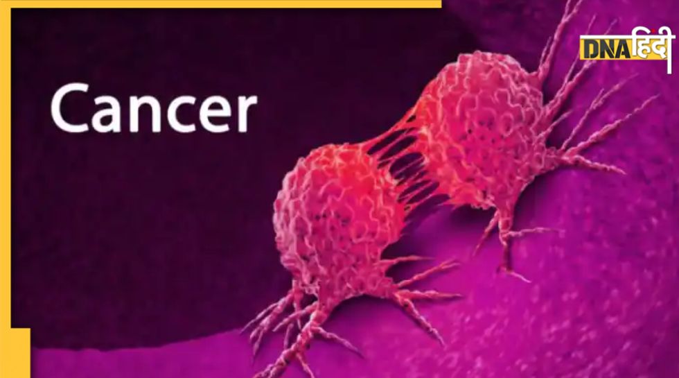 मिल गया Cancer का इलाज! 6 महीने दवा खाने से ठीक हो गए सभी मरीज