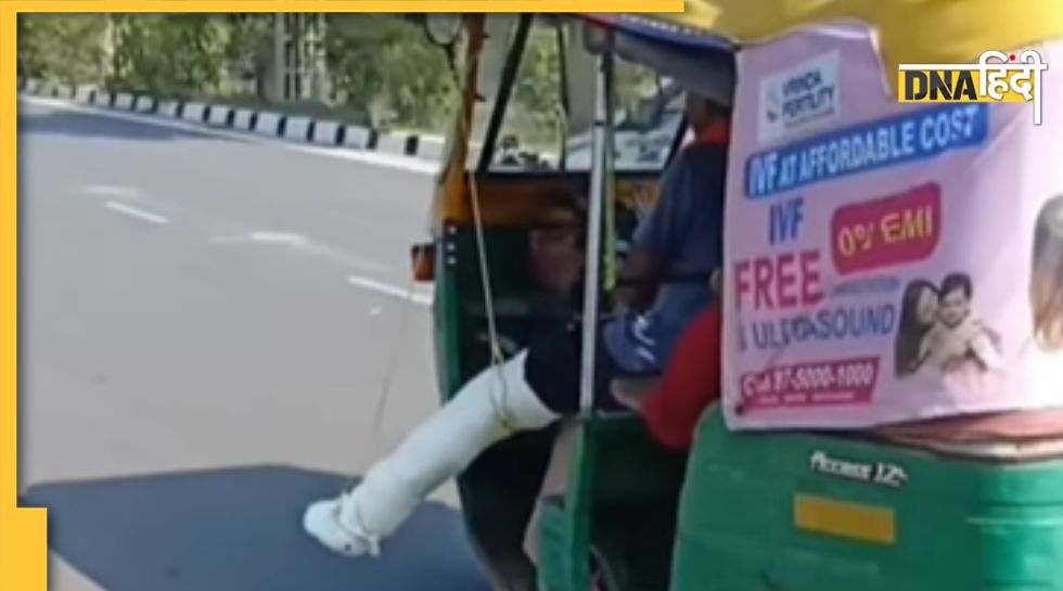 Video: टूटे पैर को रस्सी से बांध सड़कों पर चला रहा था ऑटो, मजबूरी नहीं ...