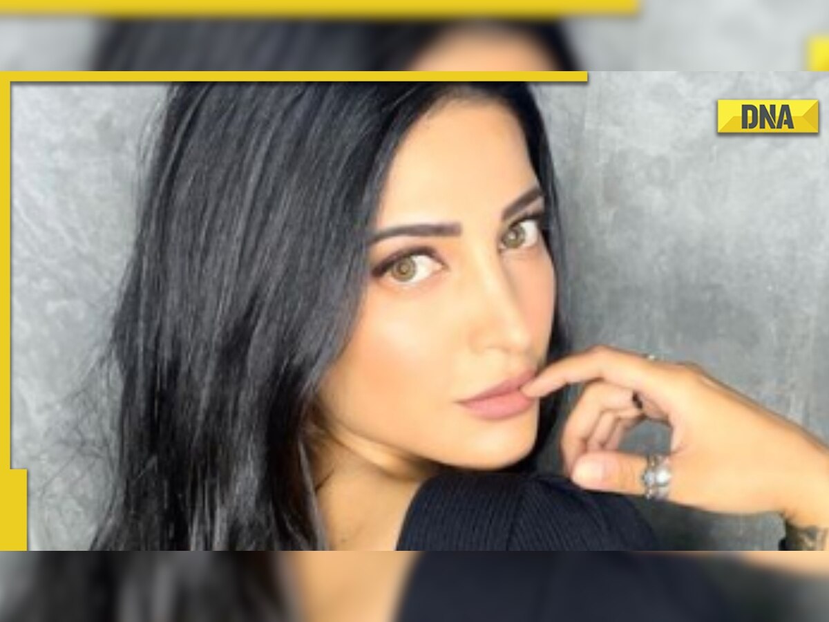 Shruti Haasan Talks About Getting Nose Job Fillers To Look ‘prettier