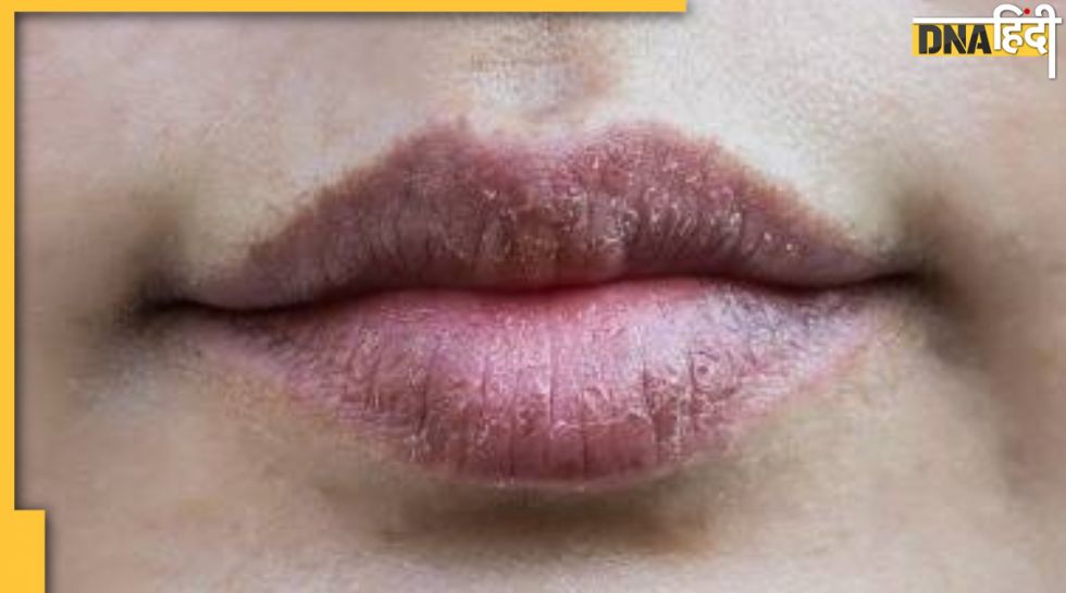 Lips Colour: काले या जरूरत से ज्यादा लाल हो रहे होंठ? तो समझ लें इन ...