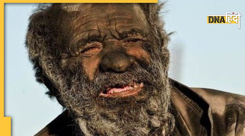 Amou Haji: 60 साल से था पानी और साबुन से दूर, हिम्मत करके नहाया और हो ...