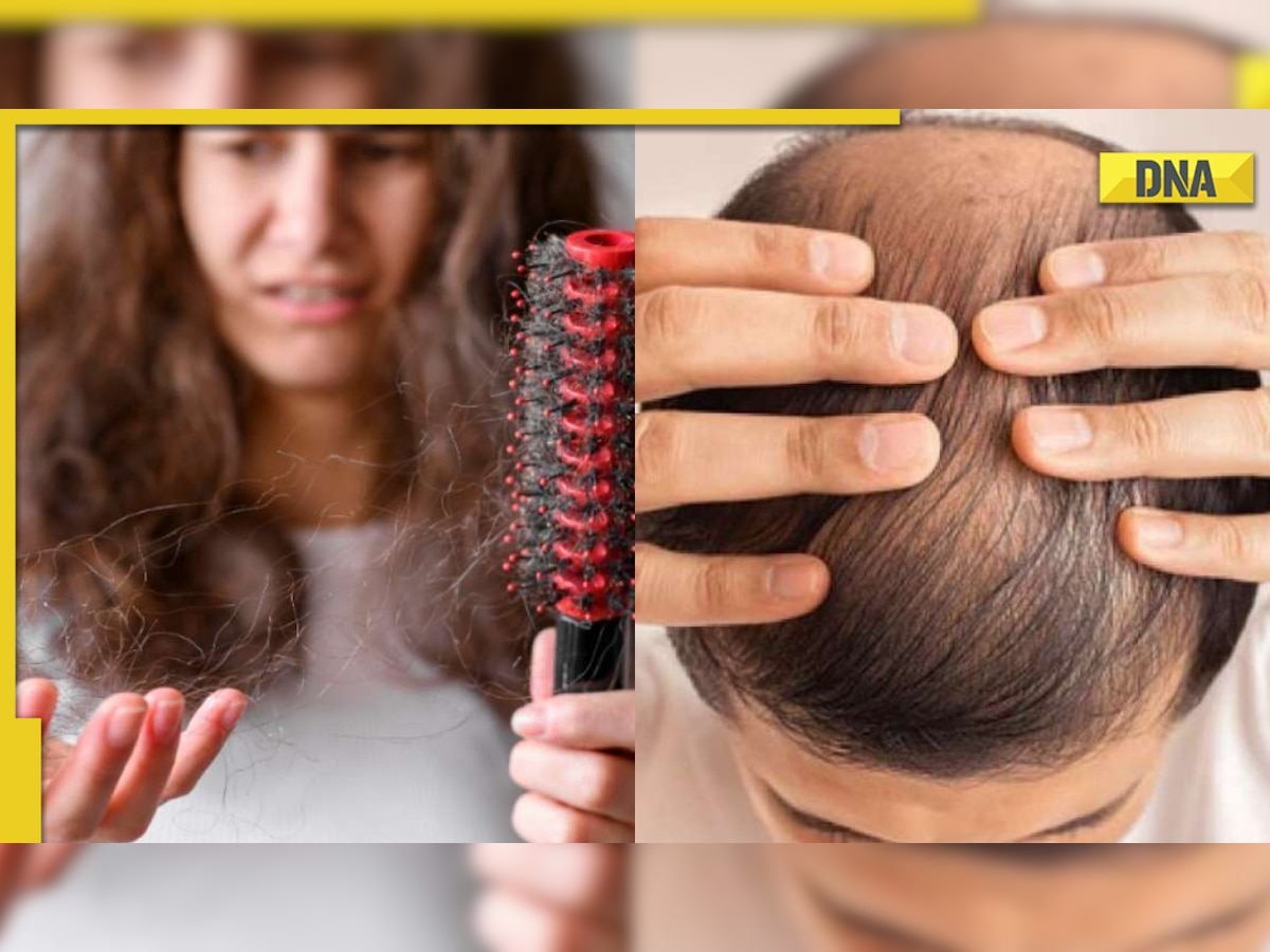 Shampoo your hair correctly to reduce excessive hairfall, here's how