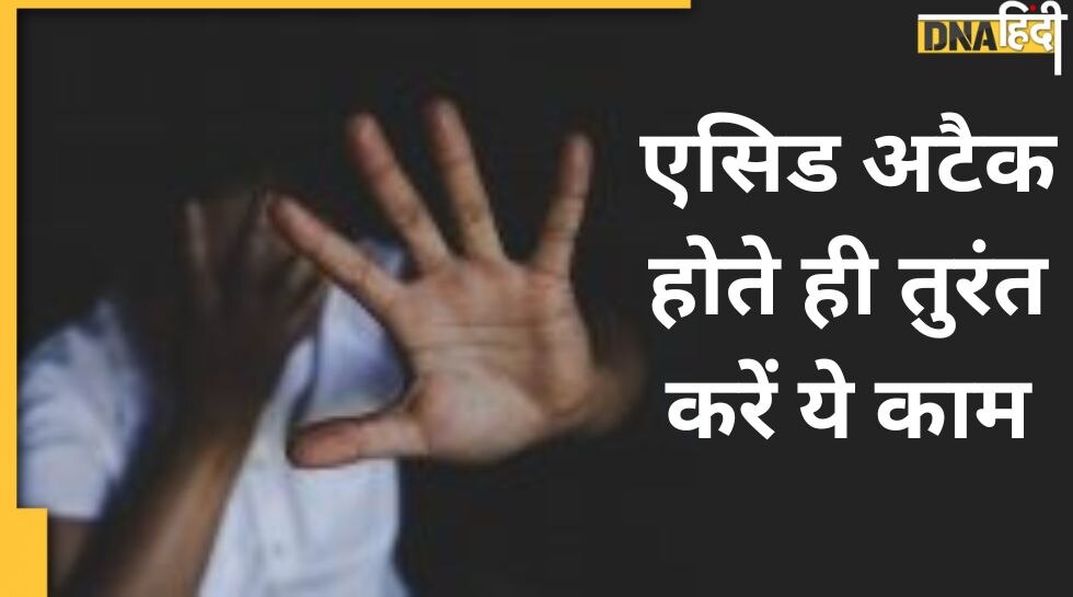 Acid Attack First Aid: एसिड अटैक होते ही तुरंत करें ये काम, स्किन जलने ...