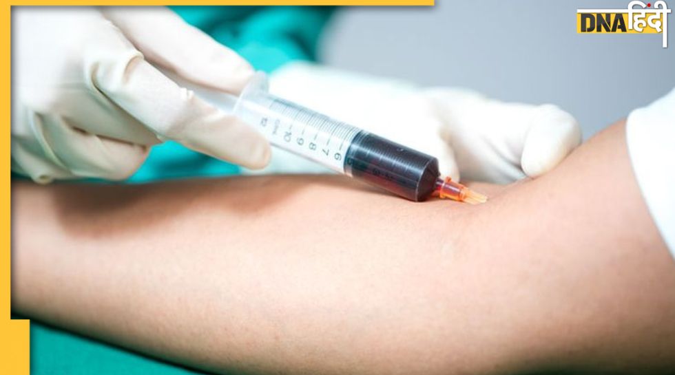 Free Medical Tests: 1 जनवरी से दिल्ली में फ्री होंगे 450 मेडिकल टेस्ट ...