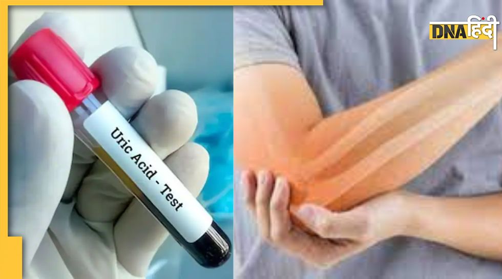 Uric Acid: बढ़ते यूरिक एसिड को रोक देता है टमाटर, डाइट में शामिल करने ...