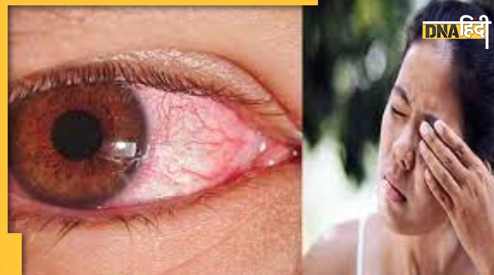 Eye Care Tips Eye Care Tips