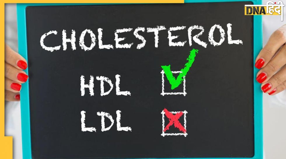 Cholesterol Alert: गुड कोलेस्ट्रॉल ज्यादा होना भी सही नहीं, हार्ट अटैक या स्ट्रोक का खतरा नहीं टलता