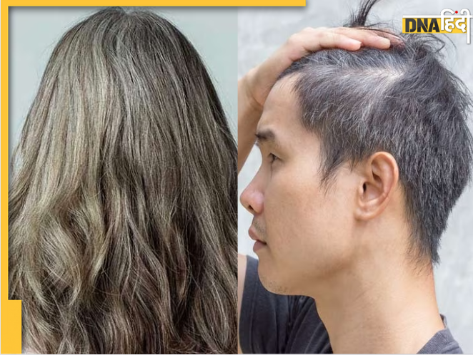 White Hair Problem: कम उम्र में ही बाल हो रहे हैं सफेद या ग्रे तो हो ...