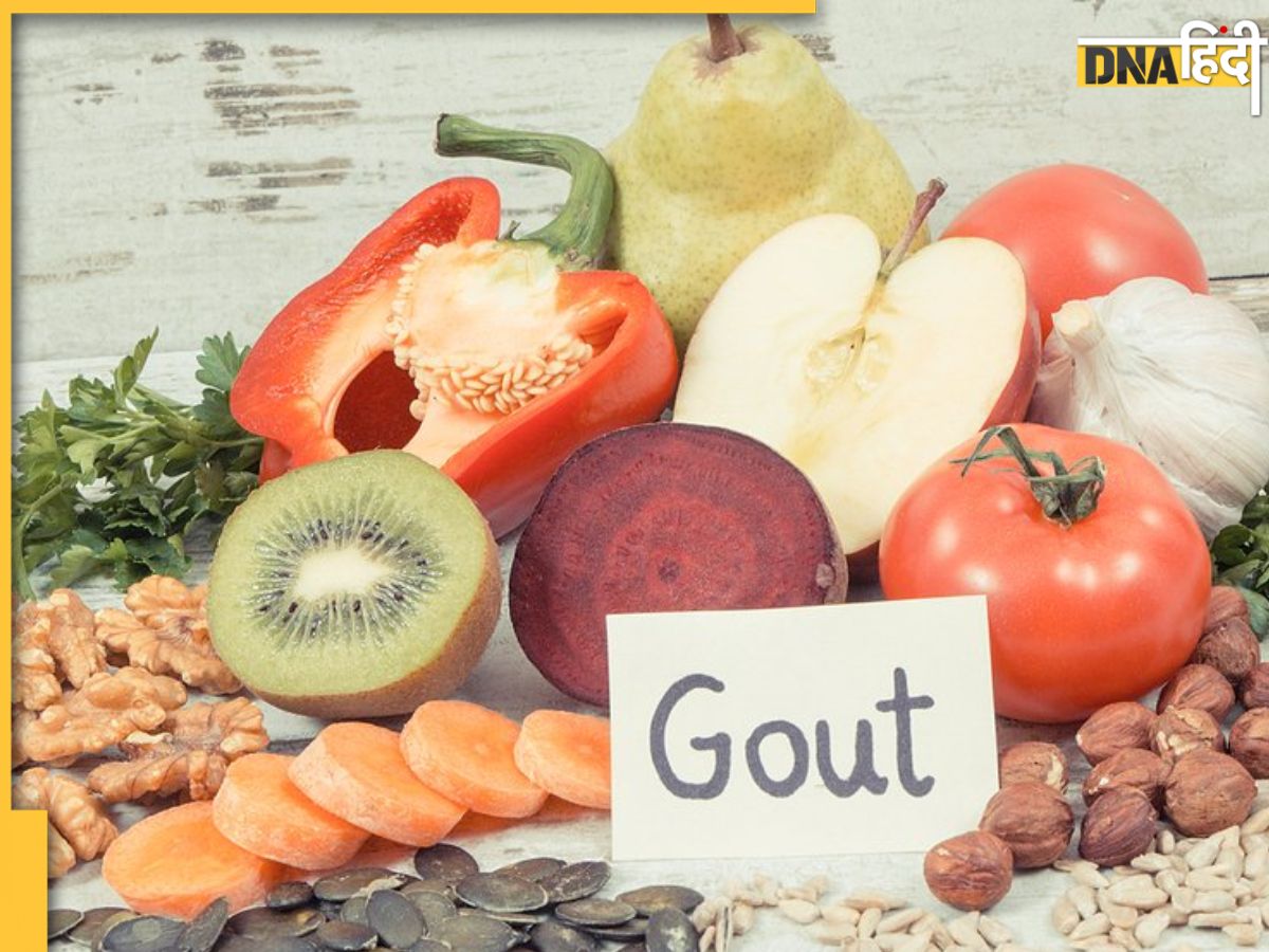 Uric Acid Remedy: यूरिक एसिड को हड्डियों से खींच कर निकाल देंगे ये 5 फल ...