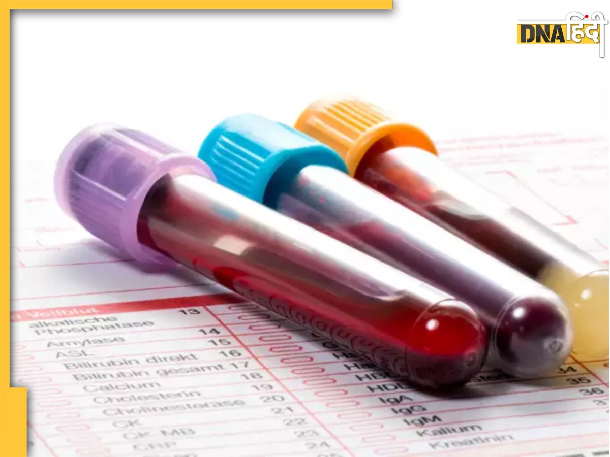 Medical Test: विवाह से पहले कुंडली की जगह करा लें ये जरूरी मेडिकल टेस्ट ...