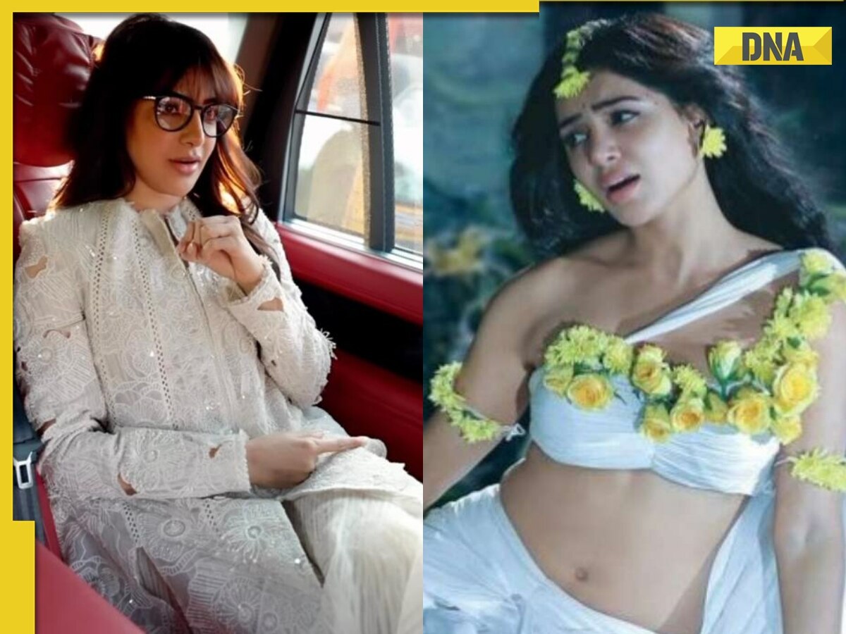 Samantha Ruth Prabhu reveals she got bit by rabbit on Shaakuntalam sets, got imprint on arms ...