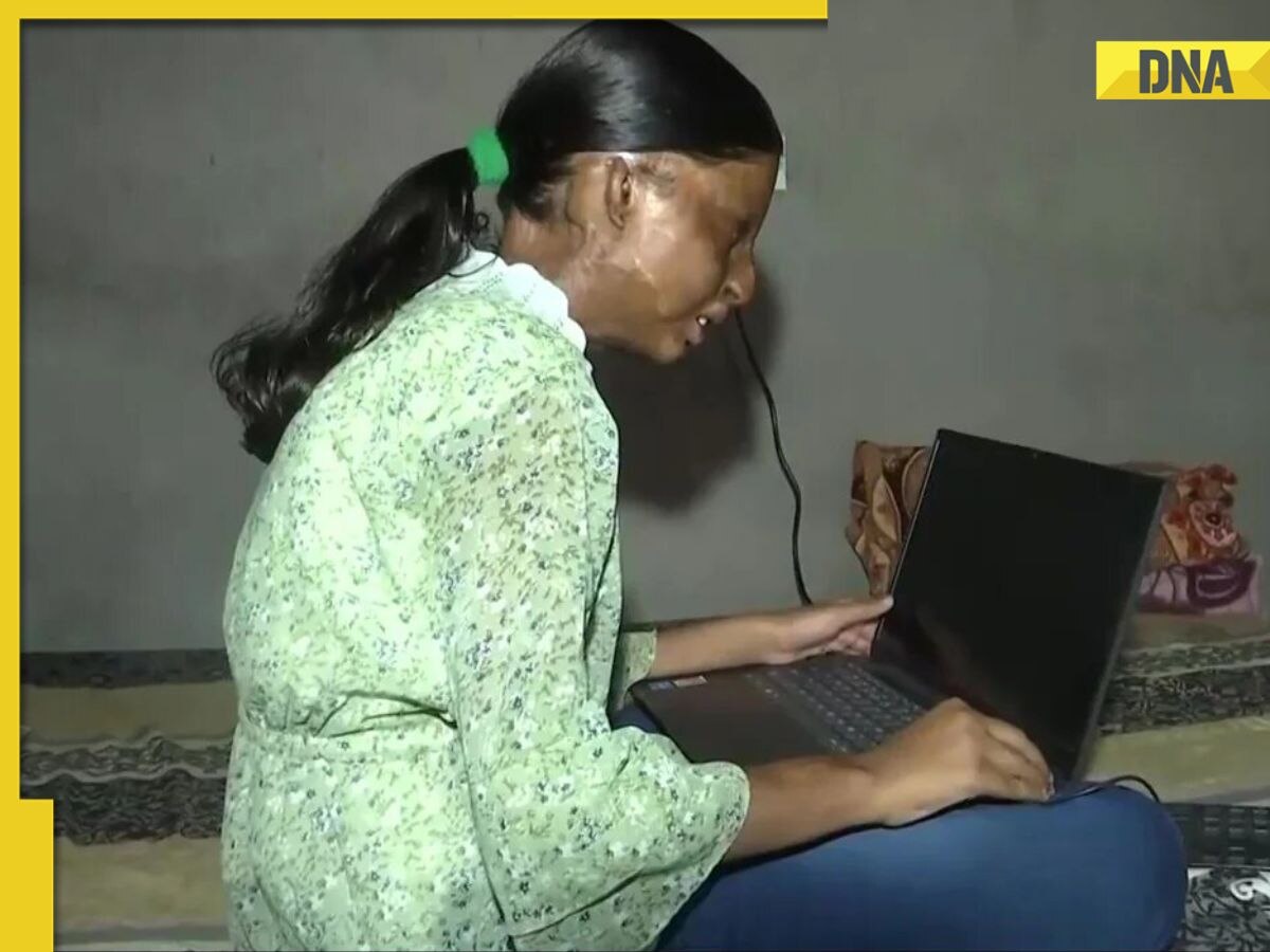 Meet Kafi, 15-year-old acid attack survivor who became CBSE Class 10 ...