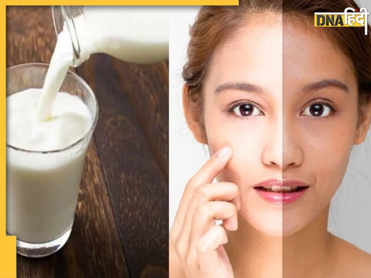 Raw Milk Benefits For Skin: फाइन लाइंस, झुर्रियों से हफ्ते भर में ...