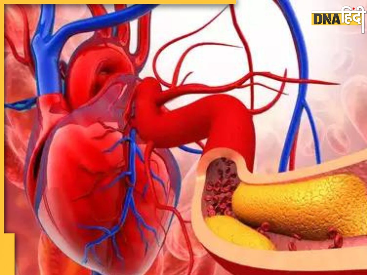 Heart attack Risk: कोलेस्ट्रॉल से भी खतरनाक हैं ब्लड में इस एक चीज का ...