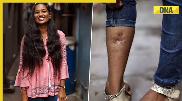 Meet girl who identified 26/11 terrorist, Kasab, at the age of 11; know ...