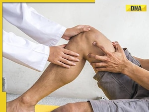 Autocart: The Tech To Treat Articular Cartilage Defects