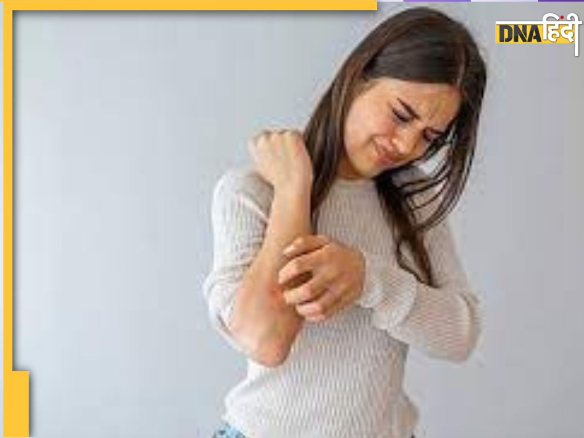 Ayurvedic Remedy For Skin Disease: त्वचा पर चकत्ते, गंभीर खुजली और जलन ...