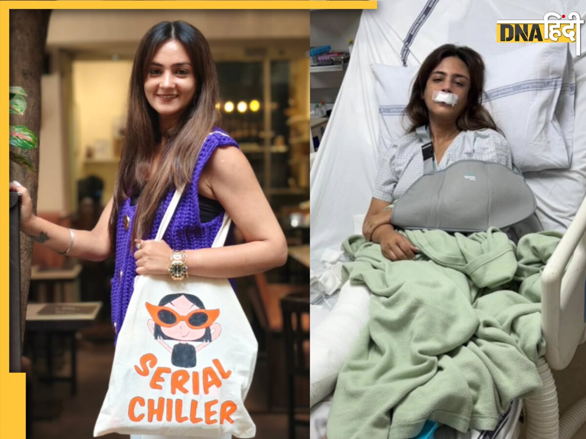 Salman Khan की राखी बहन के साथ हुआ बड़ा हादसा, लगी गंभीर चोट, फोटो देख ...