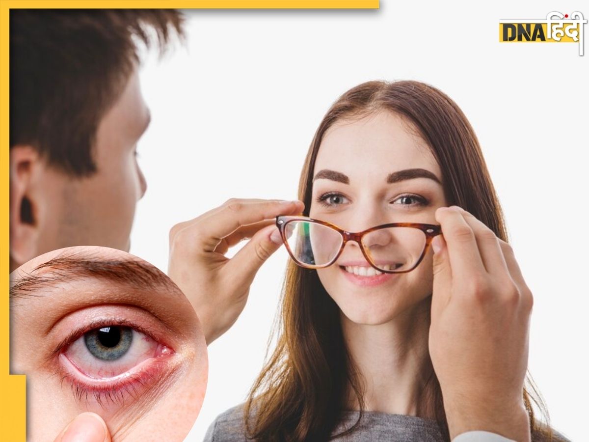 इन कारणों की वजह से होता है Motiyabind, भूलकर भी इग्नोर न करे इसके ये लक्षण