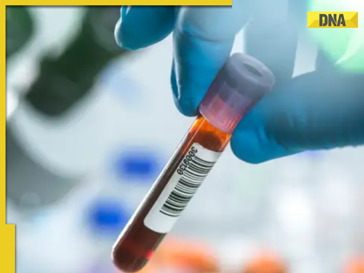 World's most expensive blood, price is over 12 lakh rupees per litre ...