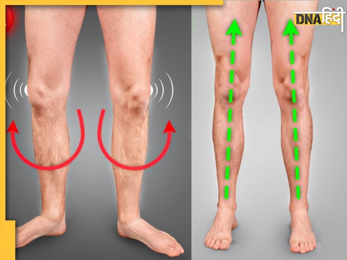 Duck Feet Walking: क्या है डक फीट वॉक? जानें 5 ऐसी एक्सरसाइज, जिससे ...