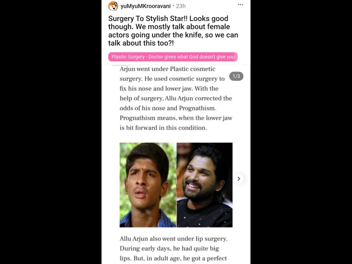 Pushpa फेम Allu Arjun ने प्लास्टिक सर्जरी से बदलवा डाला पूरा चेहरा ...