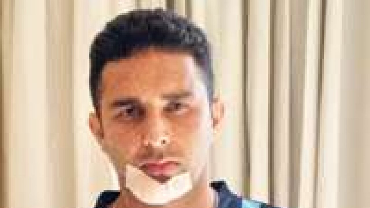 Braveheart Deepak takes the field against New Zealand