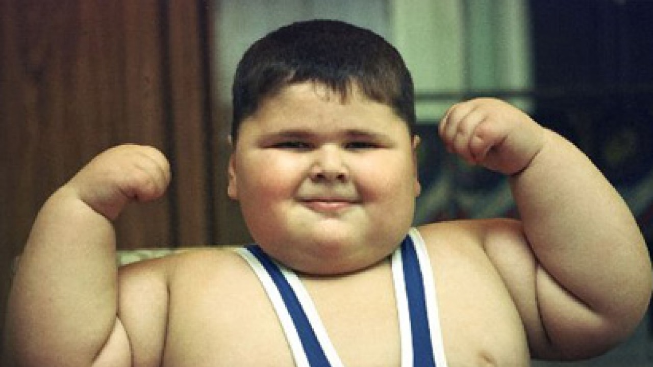 51% parents can't tell if a kid is obese