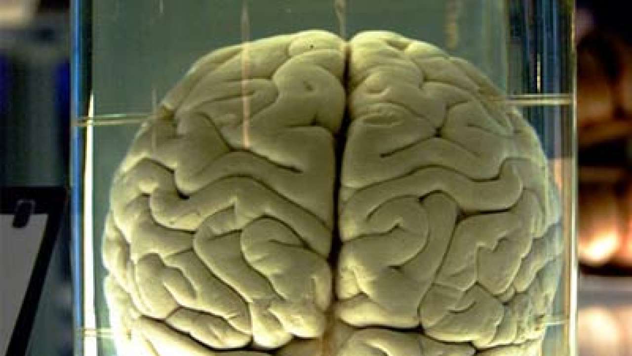 Less brain tissue not behind reading disorder