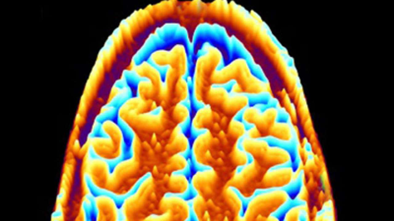 Scientists find gene linking brain's grey matter to intelligence