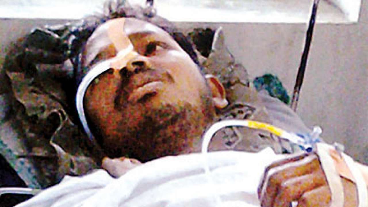 Life after train accidents: Reattaching limbs is a delicate job, so ...