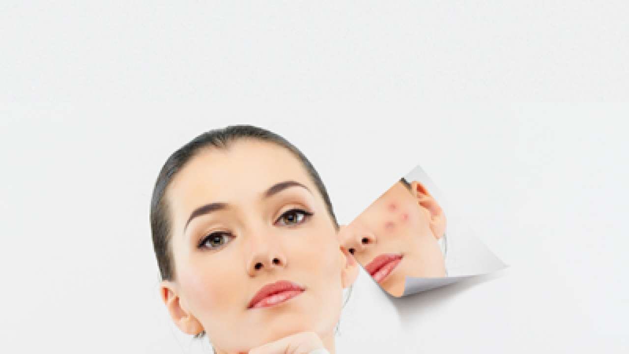 Try 'acne' app to make better food choices