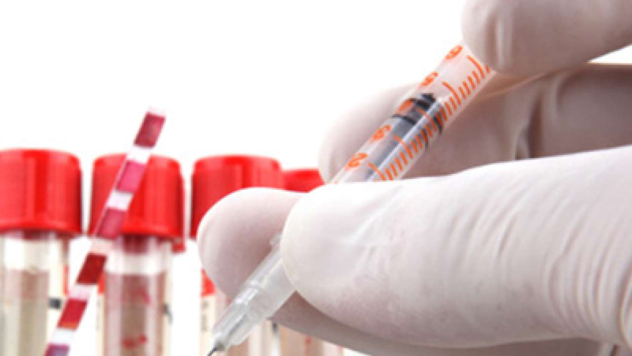 US CDC recommends combo HIV test for faster detection of virus
