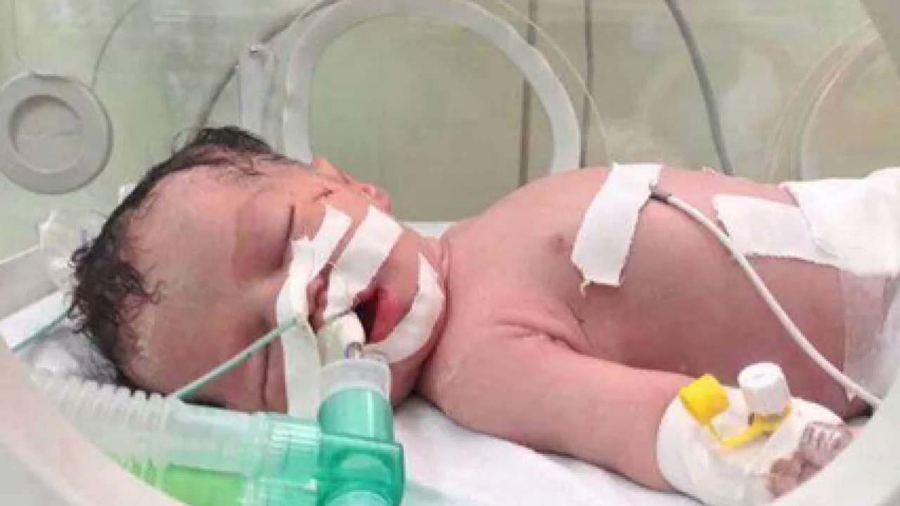[Video] Miracle baby delivered in Gaza after mother was killed in ...