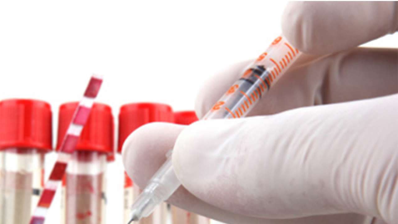 Blood test can help detect risk of Atrial fibrillation, stroke, new ...