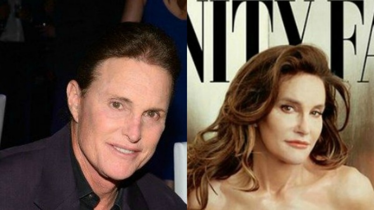 Caitlyn Jenner's surgeons happy with her transformation