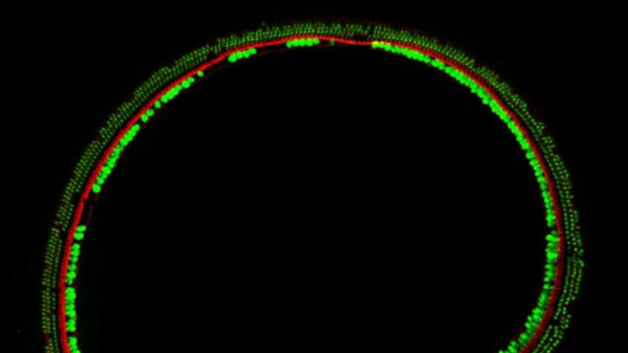 Gene therapy shows hope for the deaf to hear again: New Study